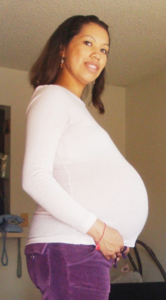 UltraShape Before and After pictures